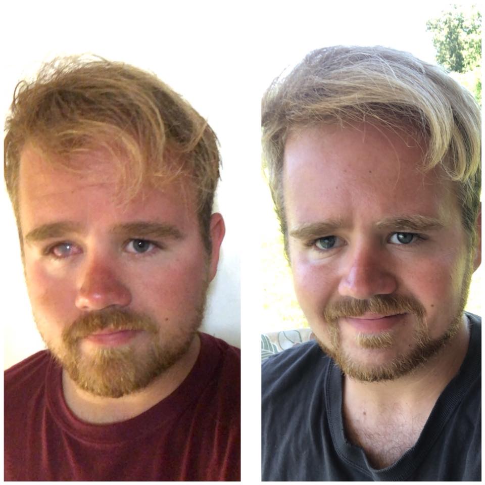 Dallas Allen – Heather Abbott Foundation